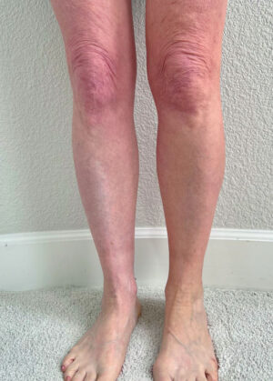 Best Self Tanners and Leg Makeup for Mature Skin - A Well Styled Life®
